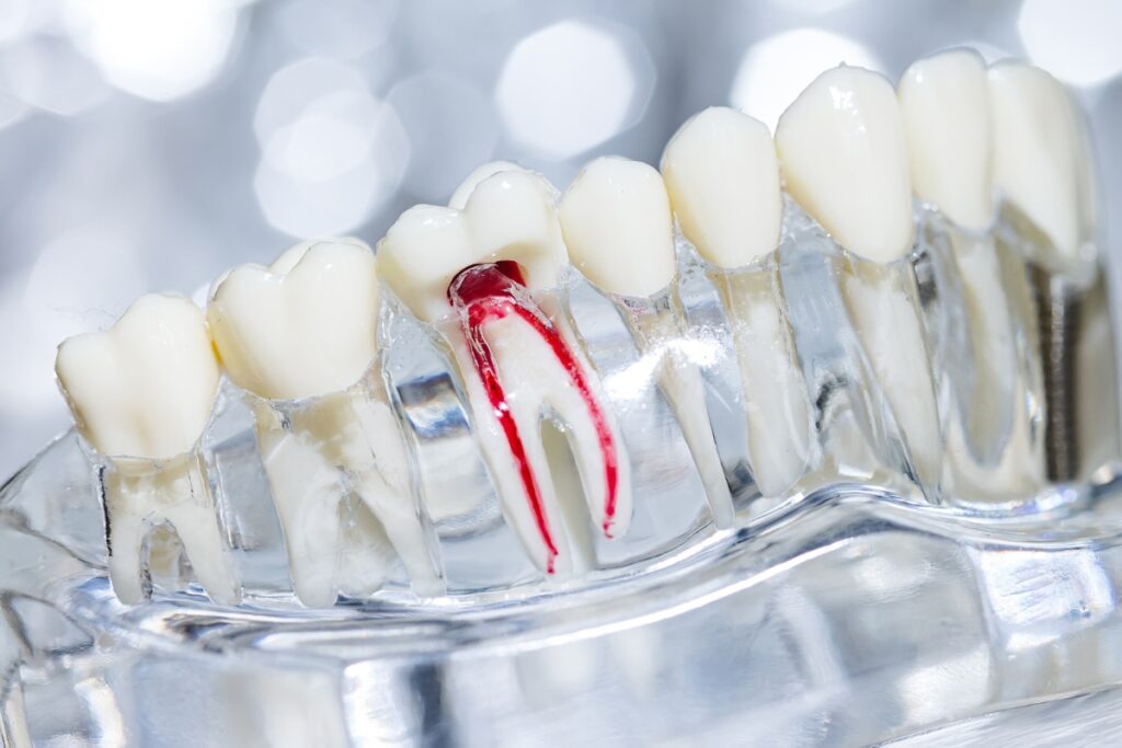 Saving Baby Teeth: Root Canal Therapy in Bradley, Illinois